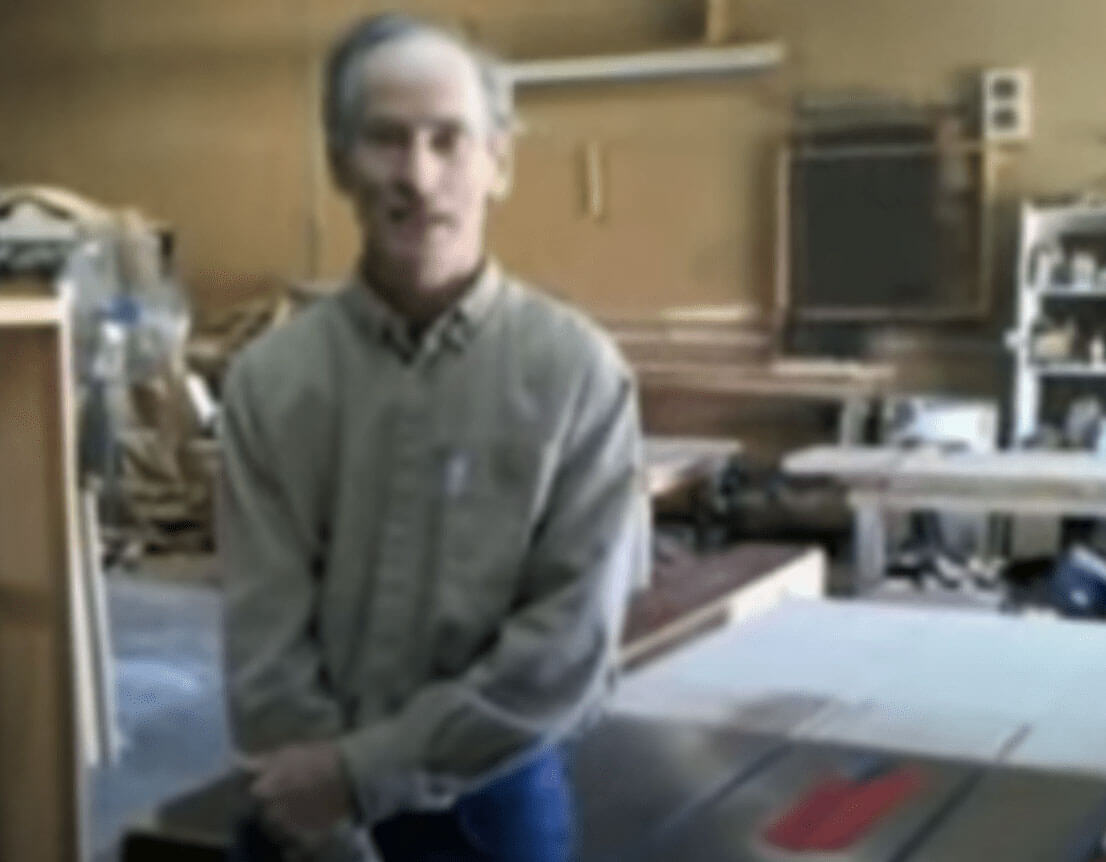 Hand Injury - Sawstop